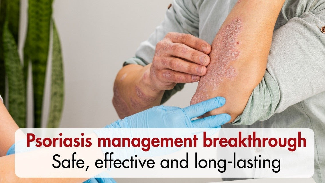 Psoriasis management: How Psorolin oil helps reduce psoriasis symptoms ...
