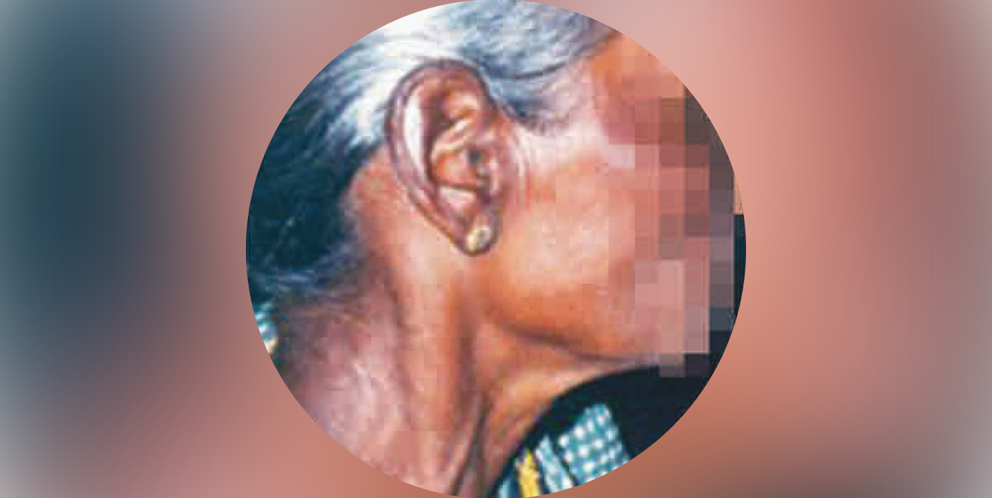 Vitiligo oil | Tolenorm oil best for Vitiligo treatment – Dr.JRK's ...