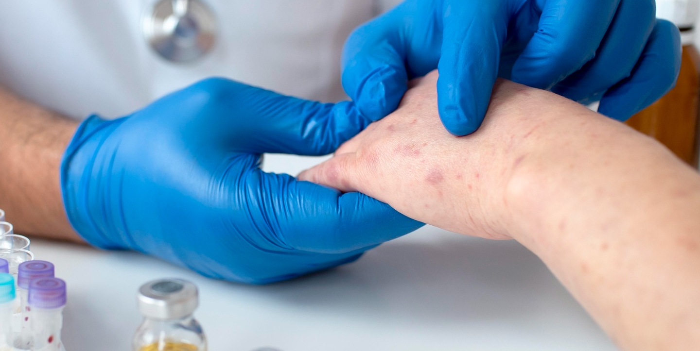 Vitiligo oil | Tolenorm oil best for Vitiligo treatment – Dr.JRK's ...