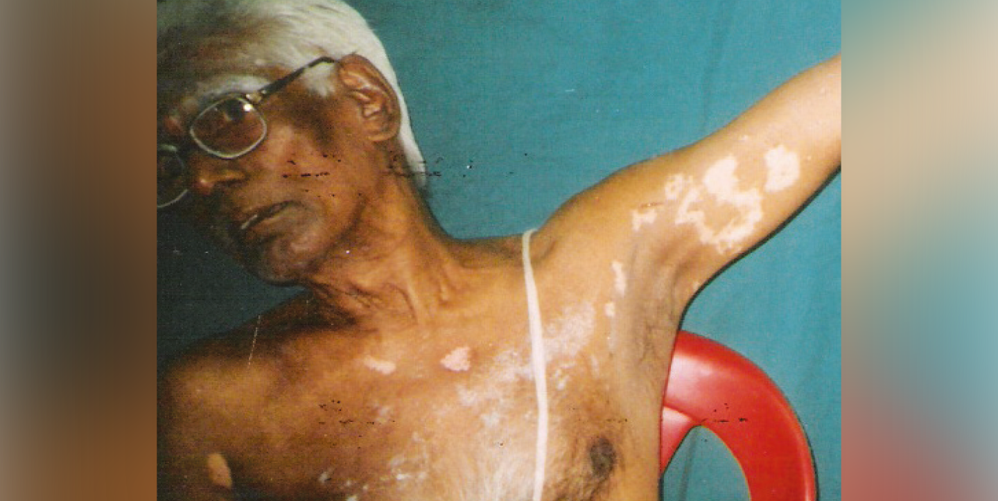 Tolenorm Ointment – Dr.JRK's Research and Pharmaceuticals